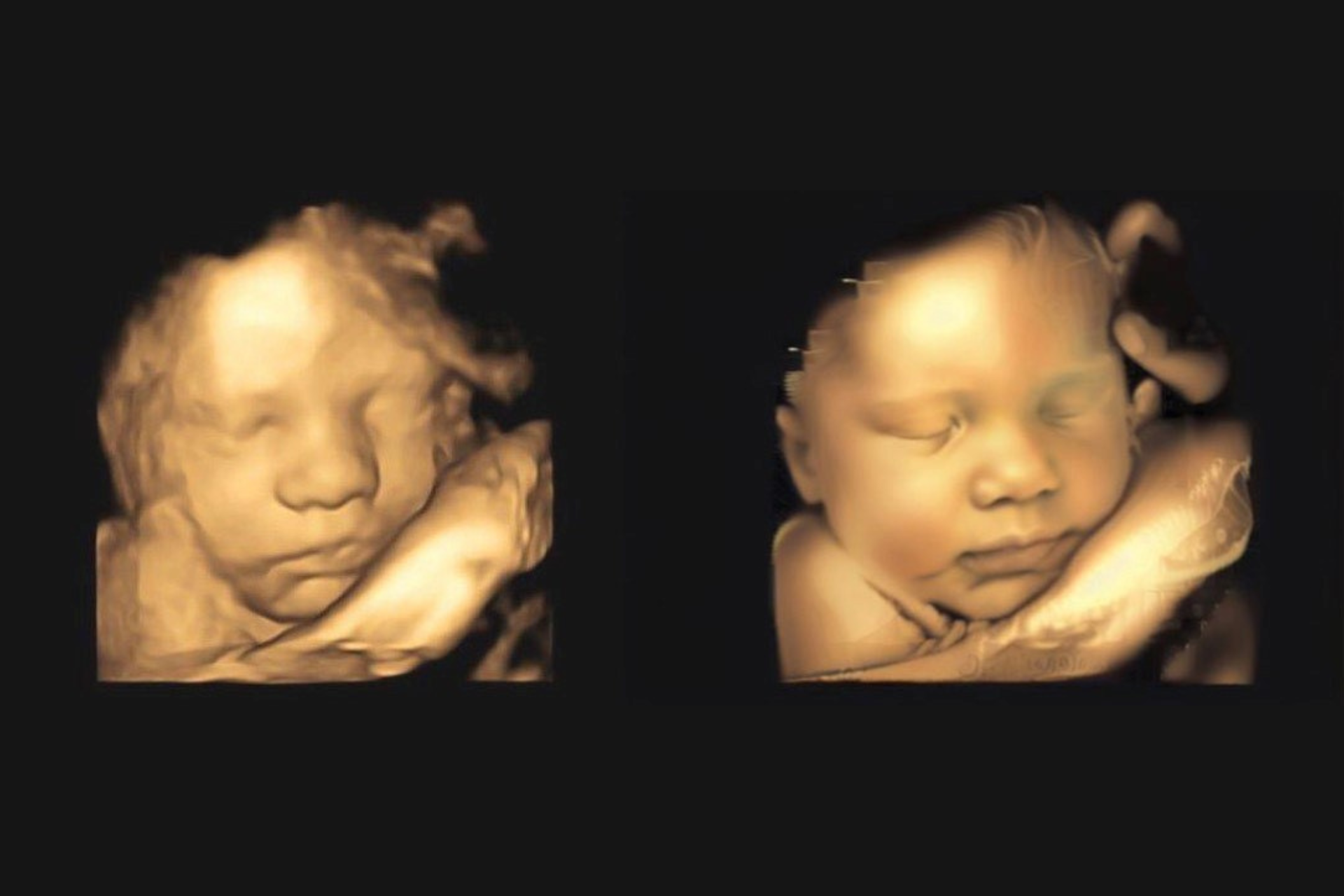 Love at First Scan | Ultrasound Imaging Studio | Crown Point